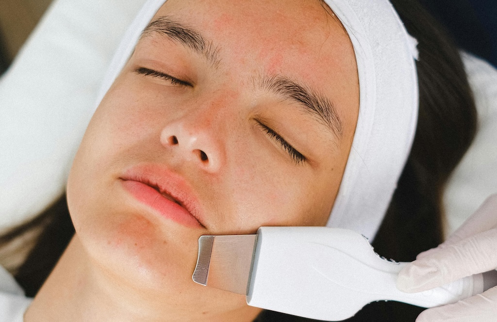 Microdermabrasion Facial | Skinnovation Laser